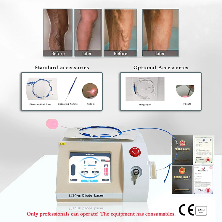 Aparat Dioda Laser 980nm + 1470nm Endovenos Indepartare venectazii ...