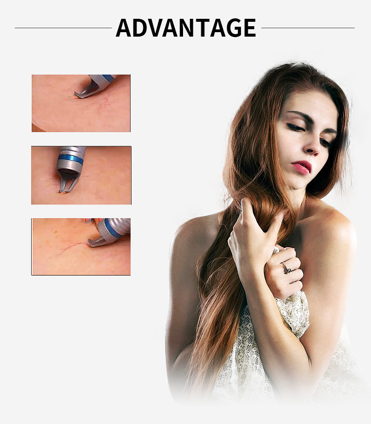 Aparat Dioda Laser 980nm, Indepartare venectazii, Vase capilare sparte ...